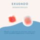 Exudado: cantidad y color para valoración - Revista Úlceras.Info