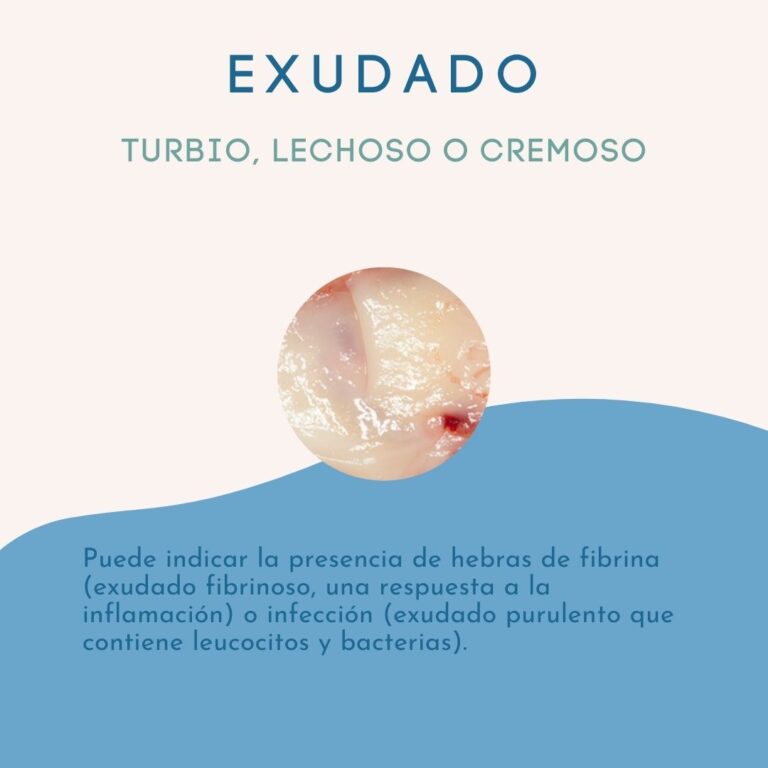 Colores de un exudado en heridas para facilitar su diagnóstico ...
