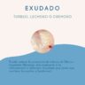Exudado: cantidad y color para valoración - Revista Úlceras.Info