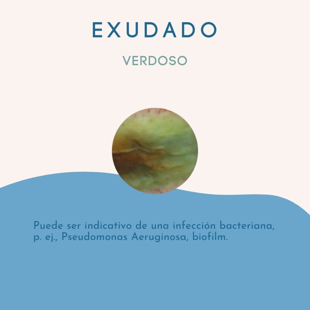 Exudado: Causas, beneficios y qué hacer con él - Revista Úlceras.Info
