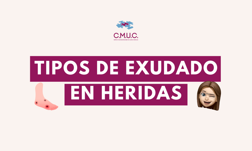 Exudado: Causas, beneficios y qué hacer con él - Revista Úlceras.Info