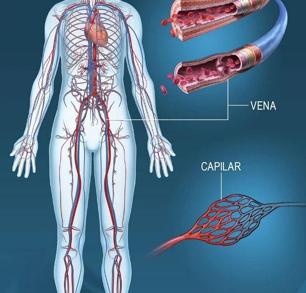 Úlcera por isquemia en extremidad superior - Revista Úlceras.Info