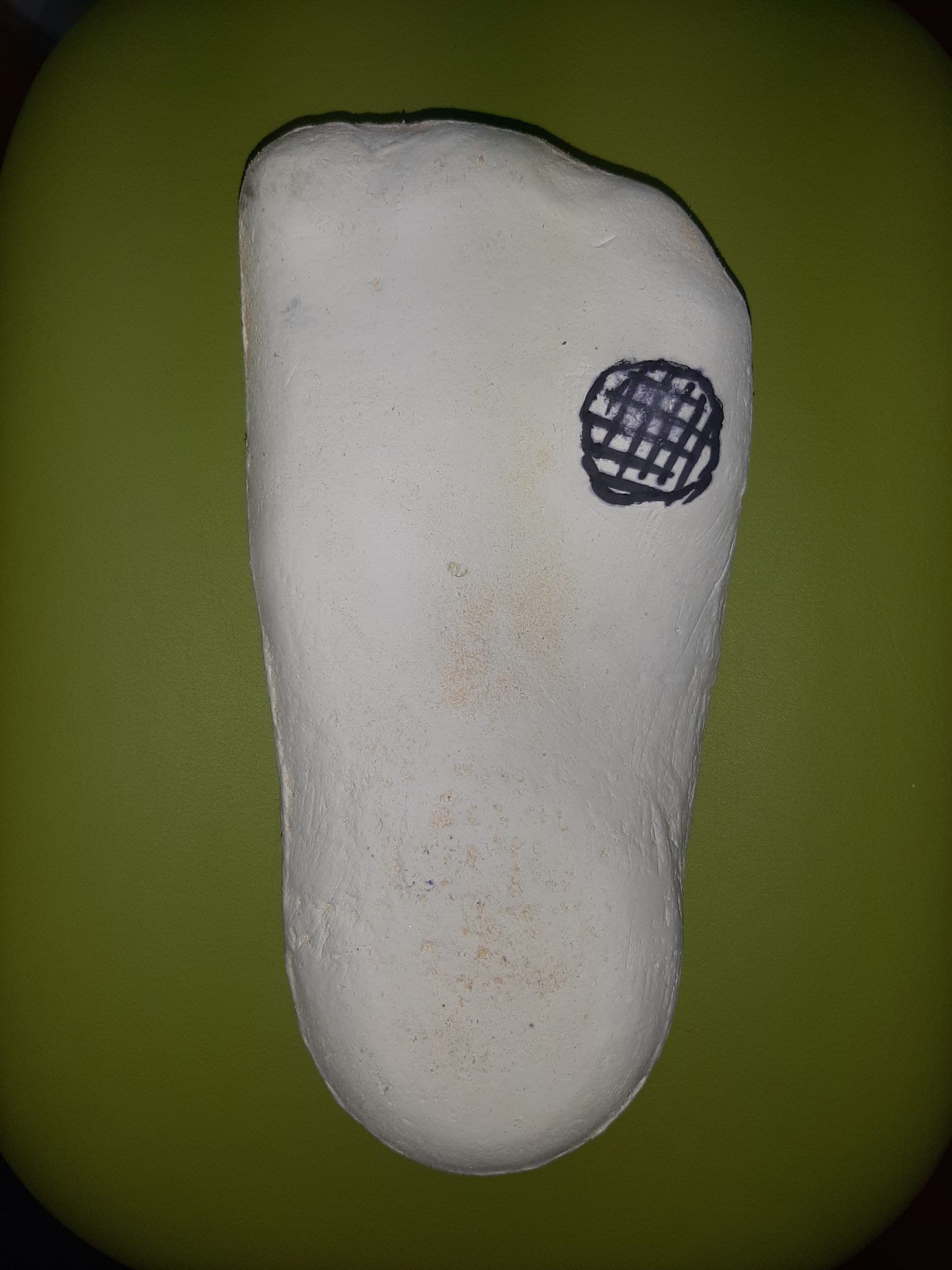 Exudado: Causas, beneficios y qué hacer con él - Revista Úlceras.Info