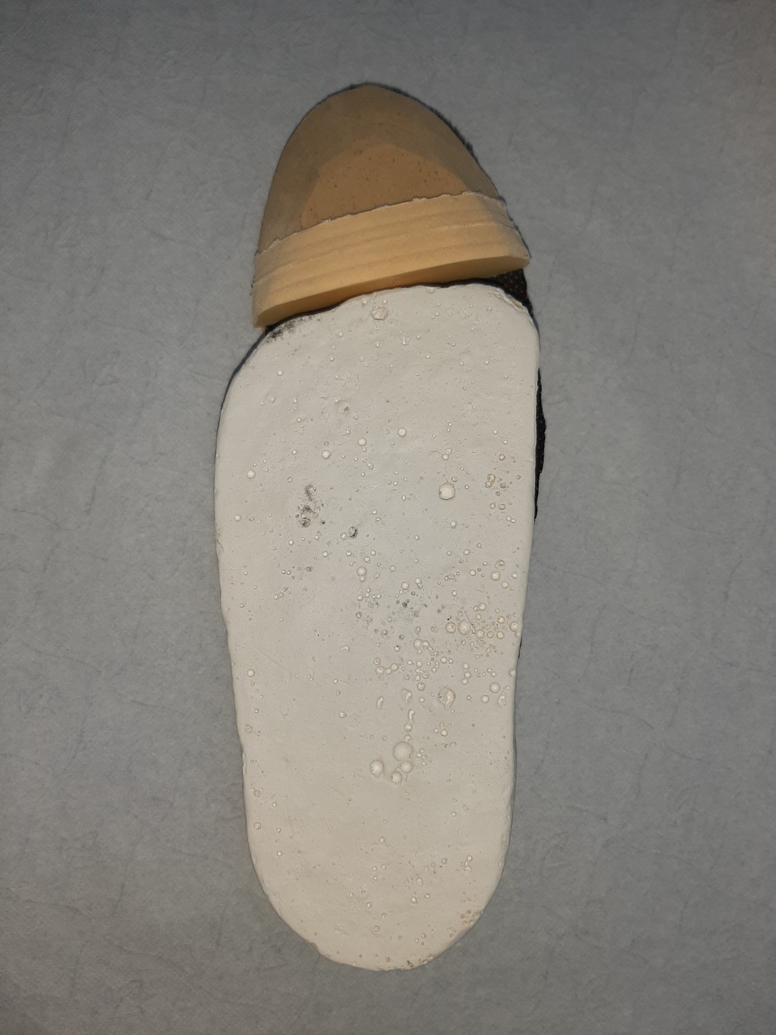 Exudado: Causas, beneficios y qué hacer con él - Revista Úlceras.Info