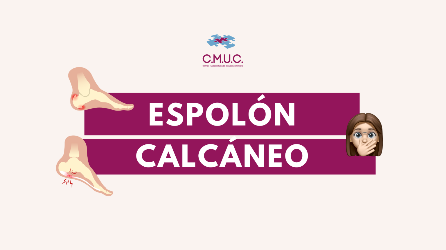 Exudado: Causas, beneficios y qué hacer con él - Revista Úlceras.Info