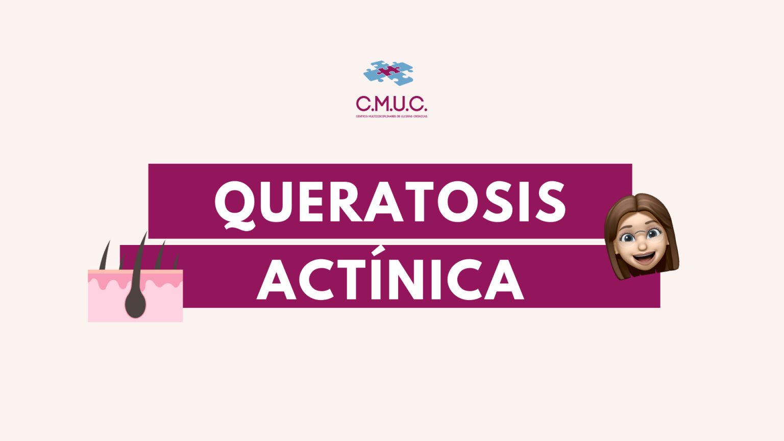 Exudado: Causas, beneficios y qué hacer con él - Revista Úlceras.Info