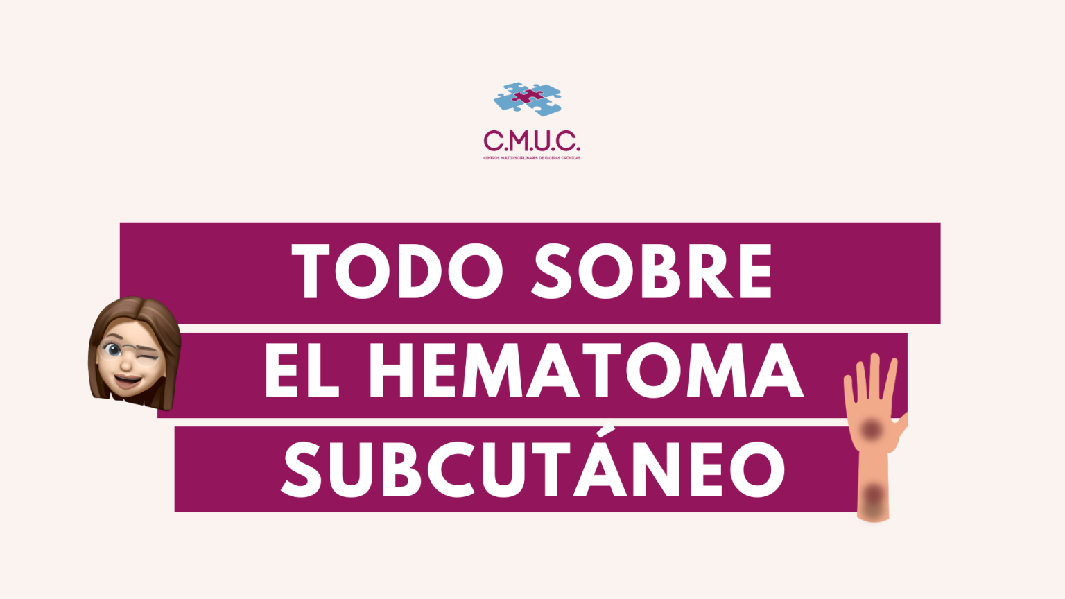 Todo lo que debes saber del Hematoma Subcutáneo - Revista Úlceras.Info